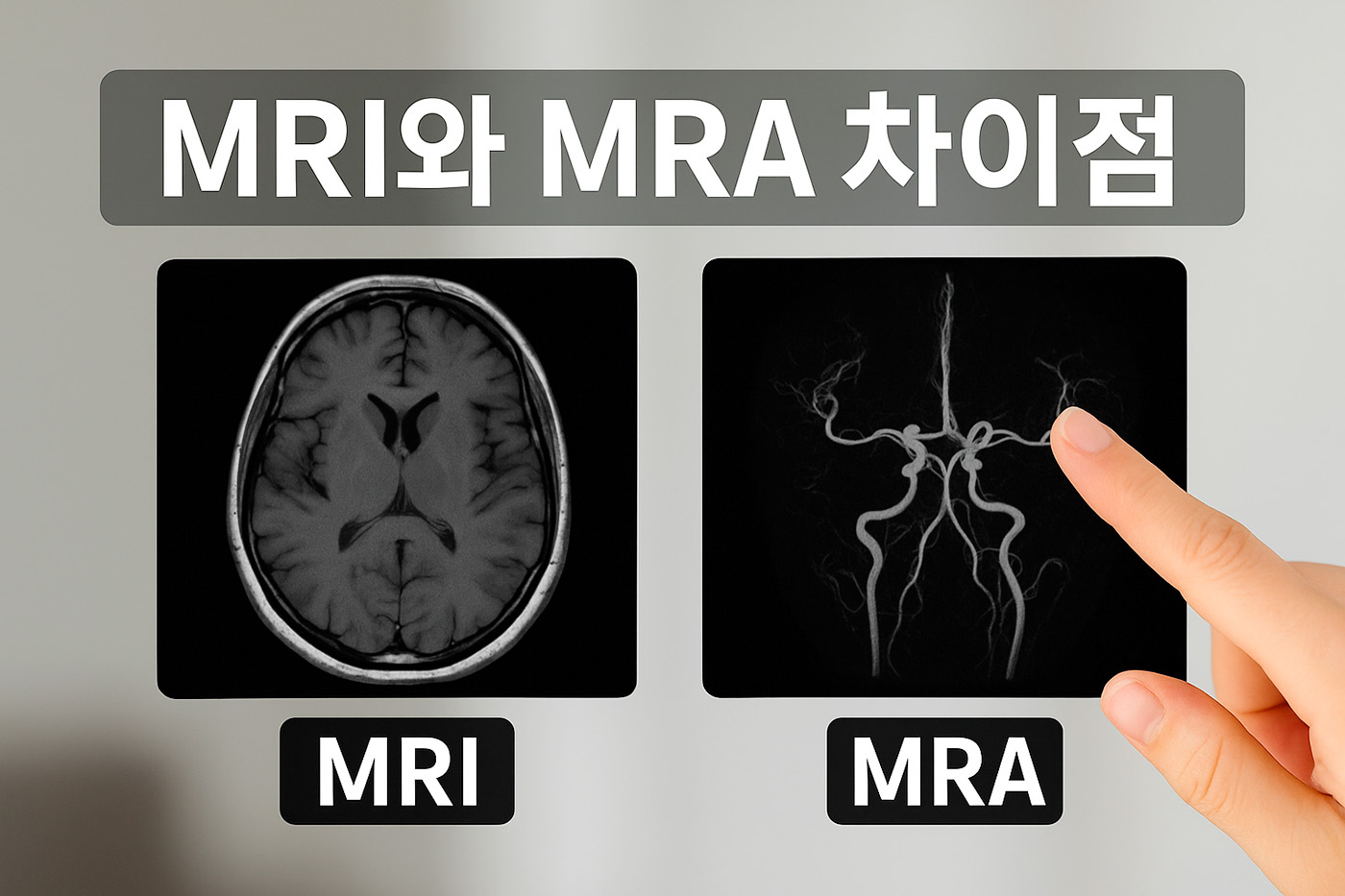 MRI와 MRA 차이점 - clickainews